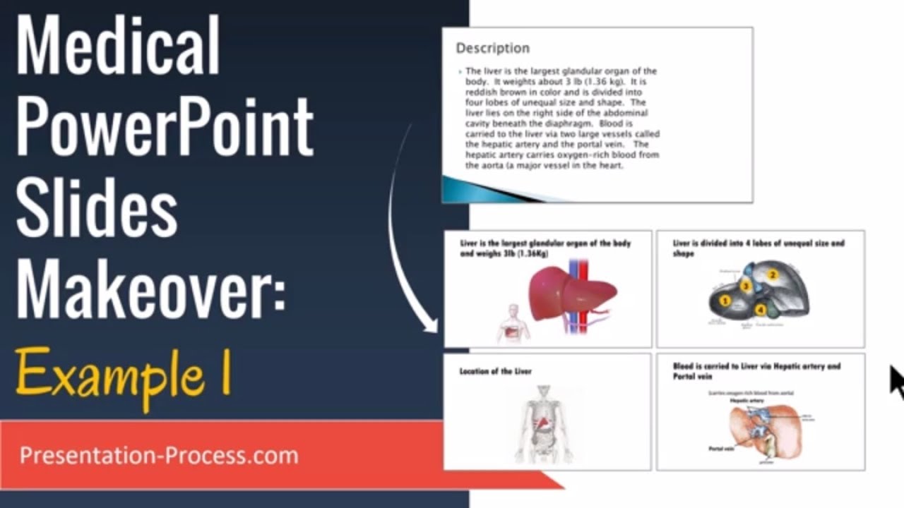 4 Medical Powerpoint Slide Makeover Videos Presentation Process